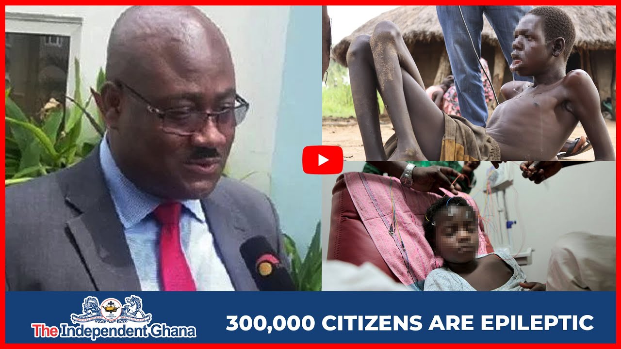 300,000 of the Ghanaian populace is epileptic - Prof. Patrick Adjei ...