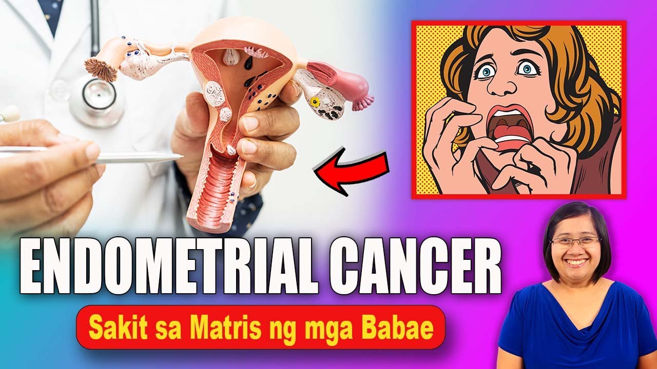 Endometrial Cancer WARNING SIGNS ~ Sakit sa MATRIS ng mga Babae ...