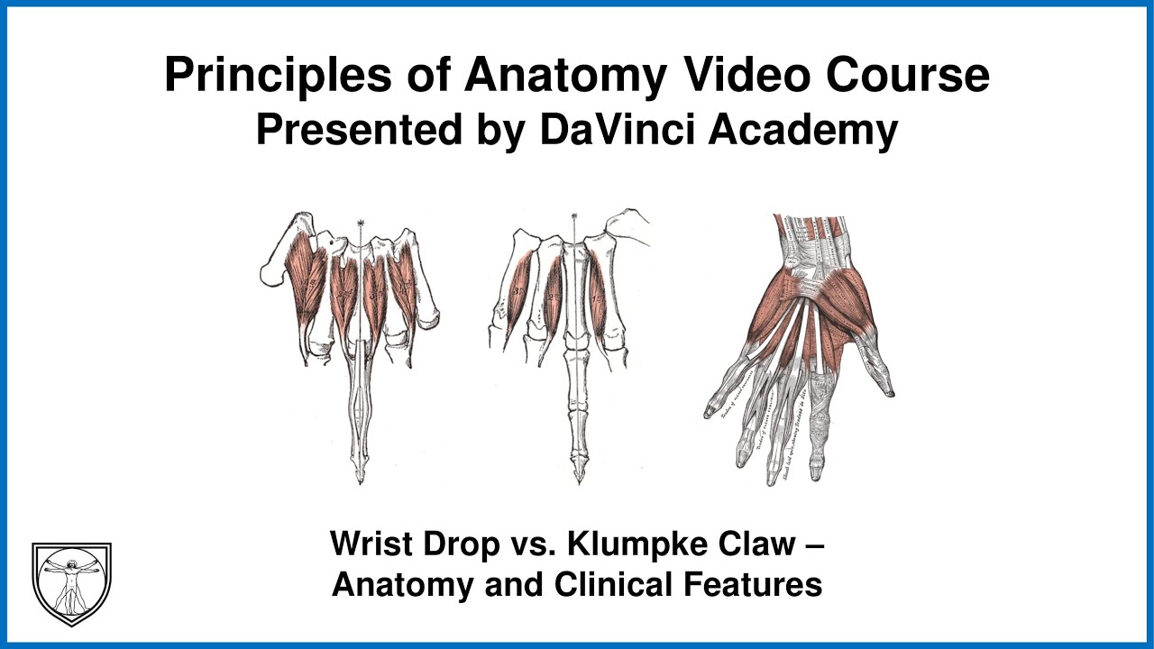 Wrist Drop vs. Klumpke Claw - Anatomy and Clinical Features [Upper Limb ...
