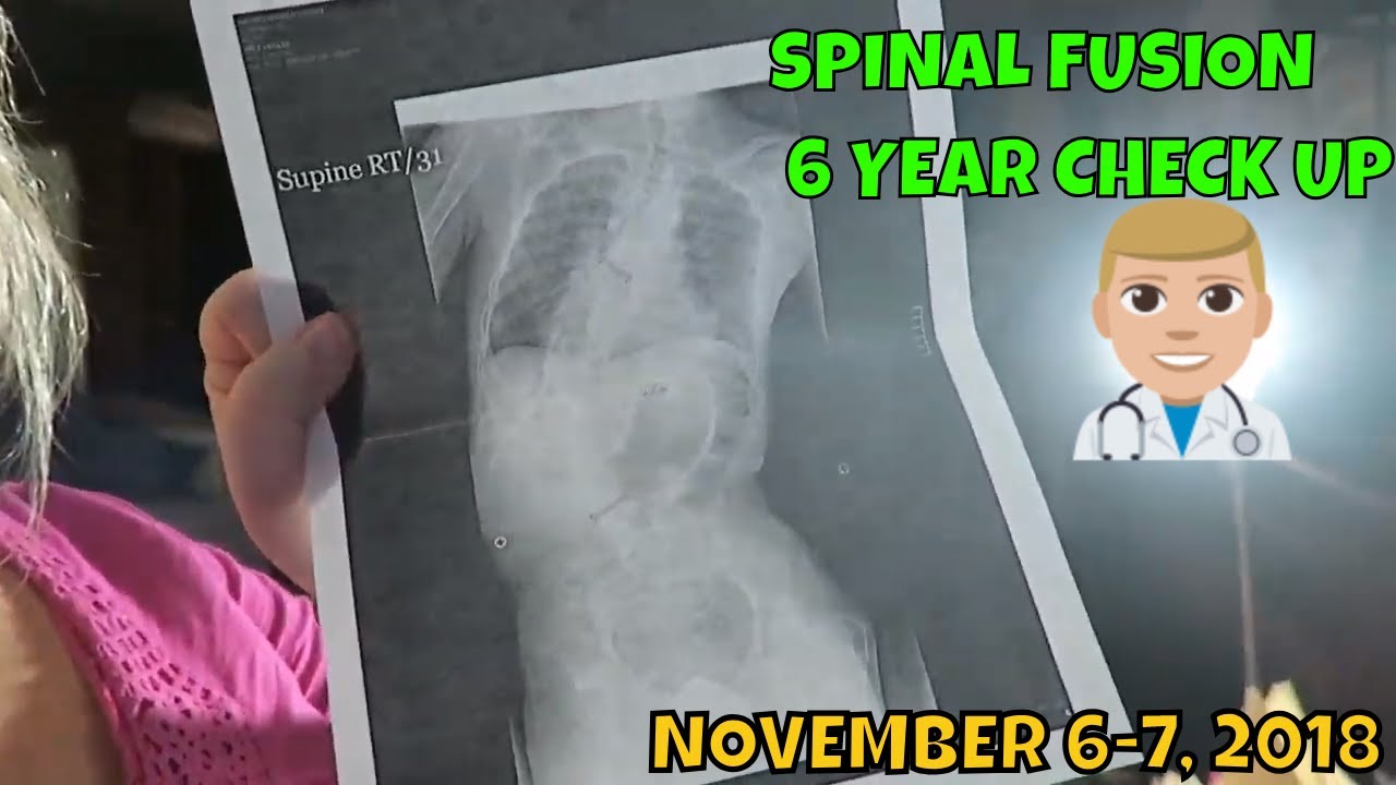 DANIELS SPINAL CHECK UP - YouTube