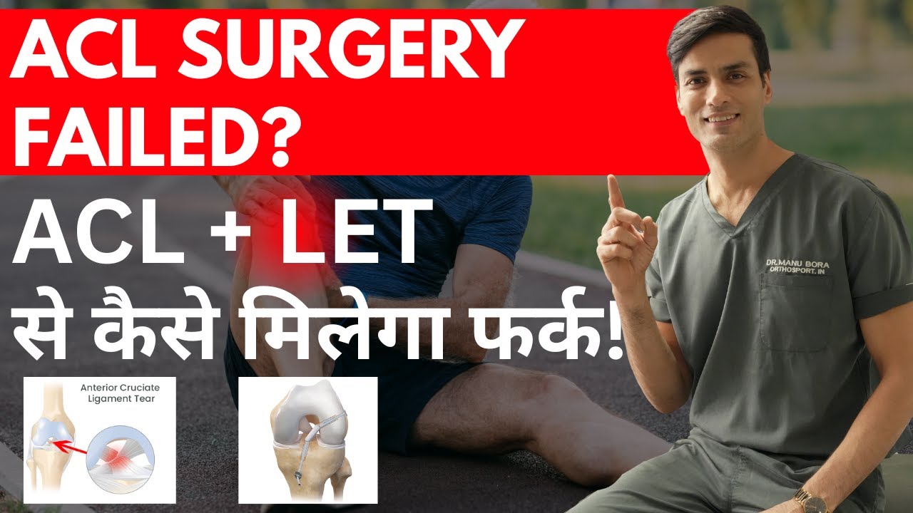 ACL सर्जरी फेल हो गई? जानें ACL + LET से कैसे मिलेगा फर्क! #aclrehab # ...
