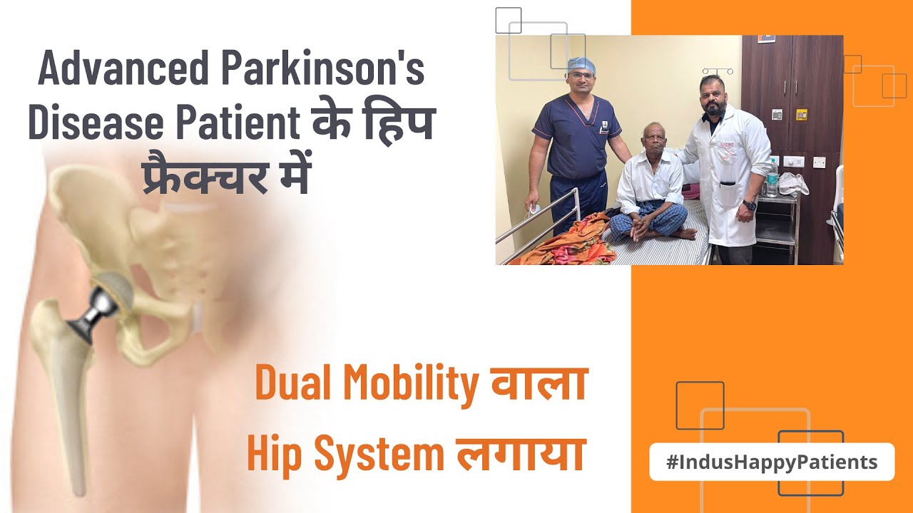 Hip fracture in Parkinson's Disease Patient | Dual Mobility Hip System ...