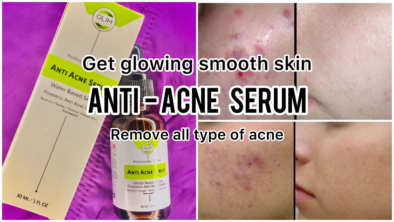 Serum for Acne | day serum for face | Sadia's tips - YouTube