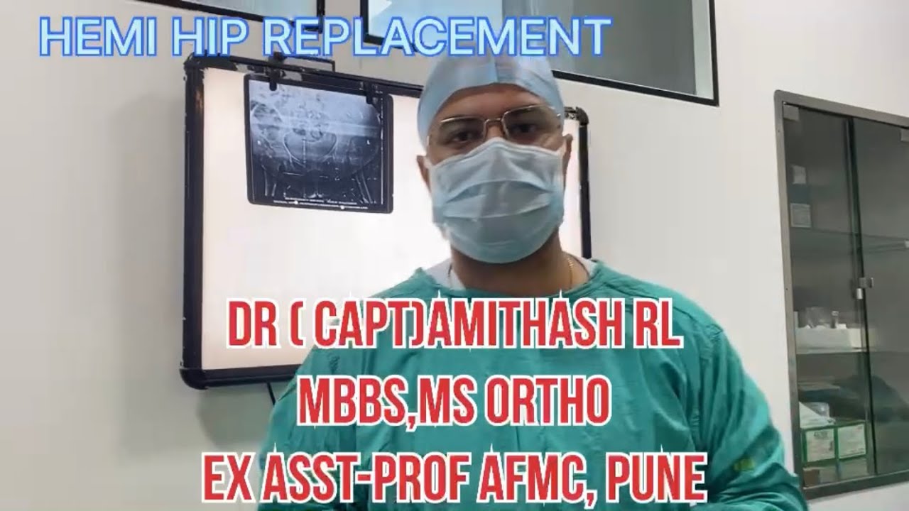 HEMI HIP REPLACEMENT SURGERY BY DR (CAPT) AMITHASH - MODULAR BIPOLAR ...