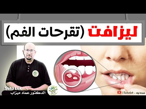 وصفة مساعدة لمحاربة  ليزافت (تقرحات الفم) / Wasafat dr imad mizab