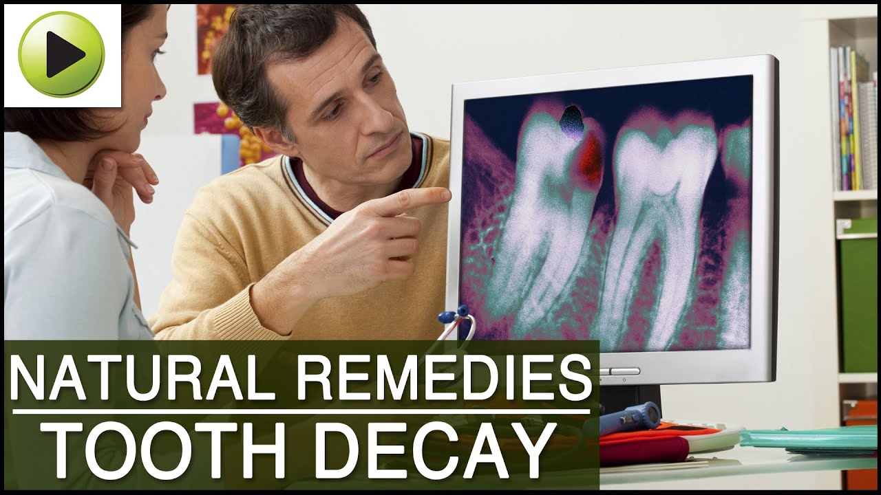 Tooth Decay - Natural Ayurvedic Home Remedies - YouTube