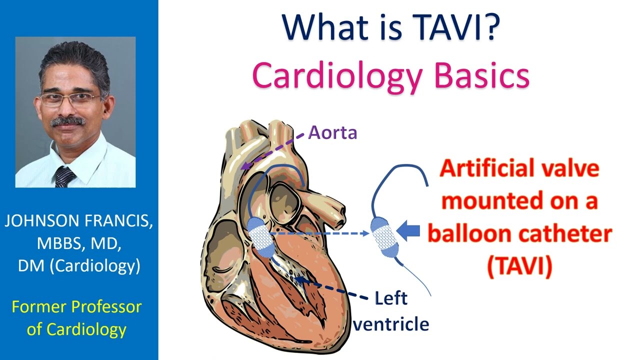What Is TAVI Cardiology Basics YouTube