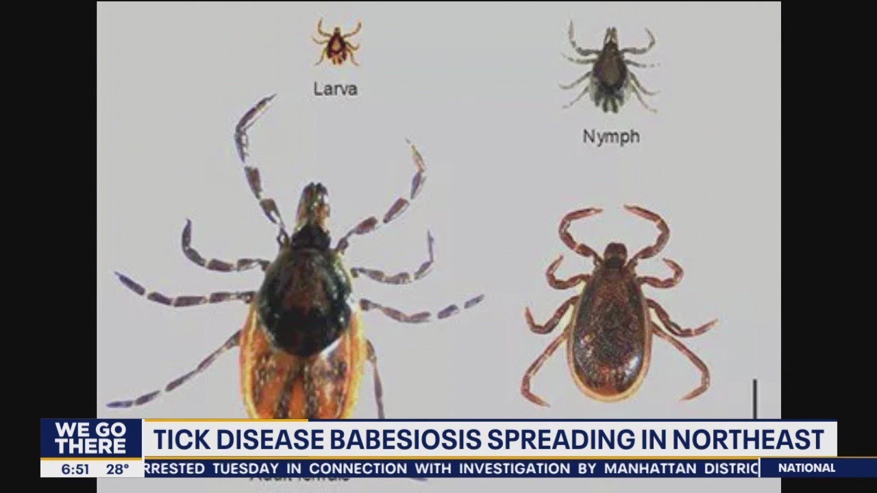 Health Watch: Tick disease spreading in Northeast - YouTube