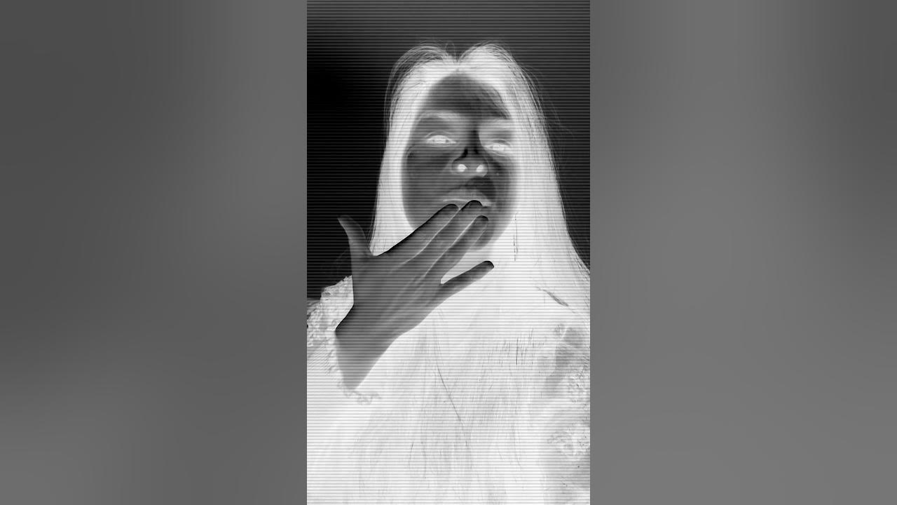 X Ray Youtube