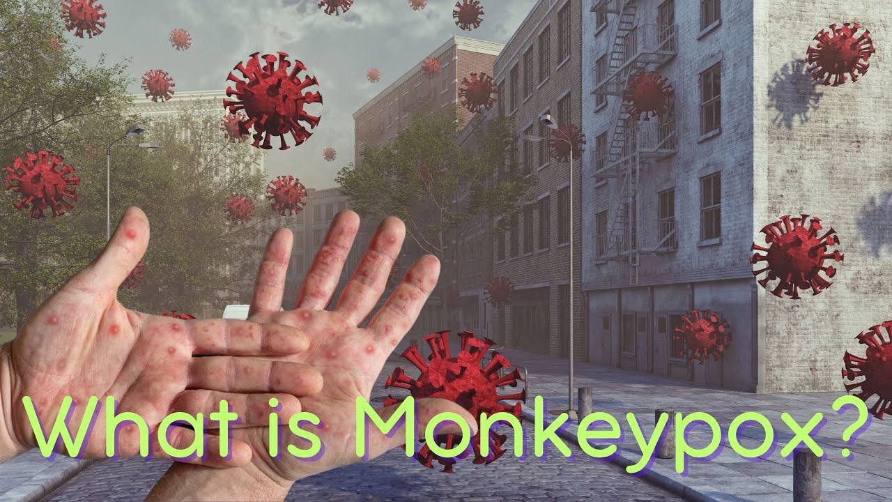 What is Monkeypox Monkeypox is a rare but serious viral illness that ...