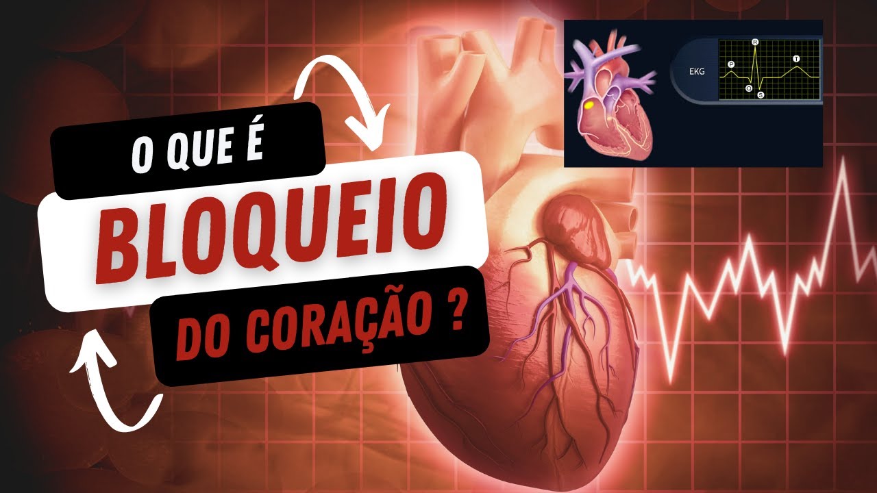 O que é bloqueio do coração? É perigoso ter bloqueio no coração? - YouTube