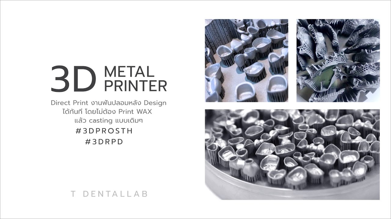 3D Metal Printer - 3D RPD ( Part 1 ) - YouTube