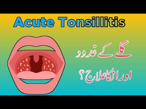 Acute Tonsillitis In Children ‖ How To Treat Tonsillitis || Medical ...