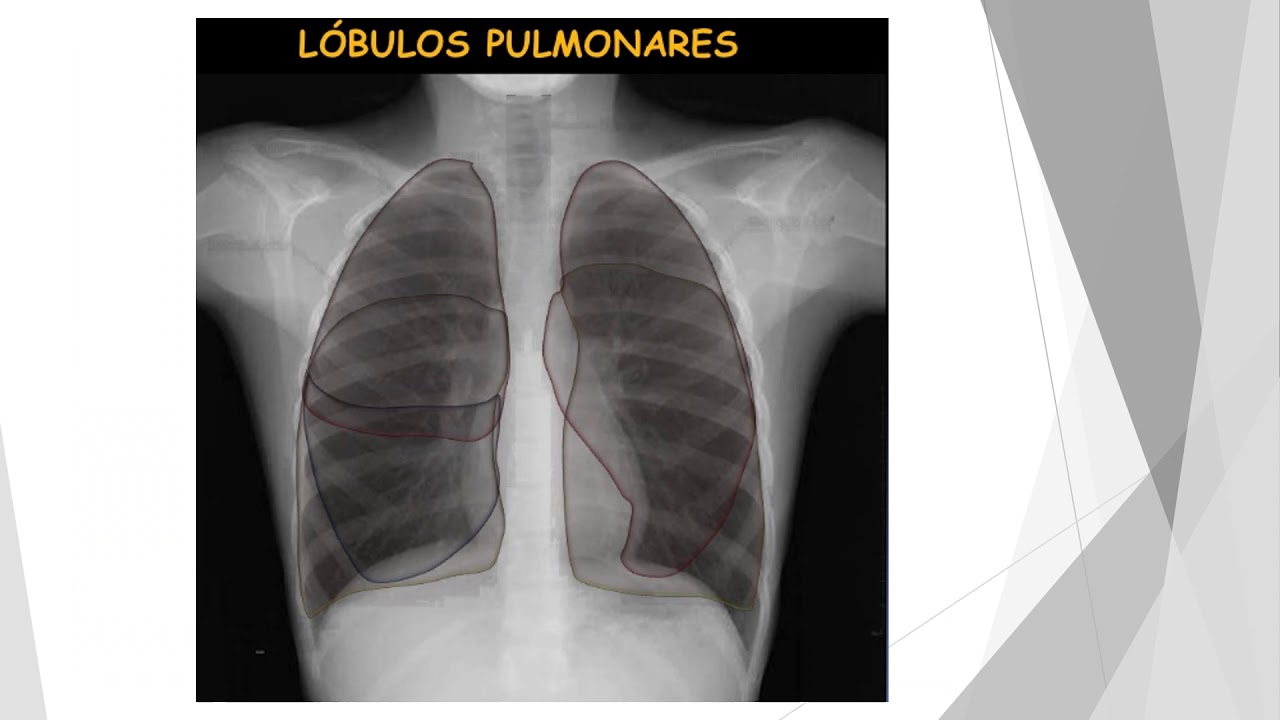 RX DE TORAX - YouTube