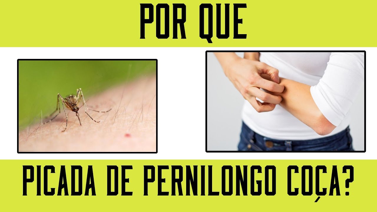 POR QUE PICADA DE PERNILONGO COÇA? - YouTube