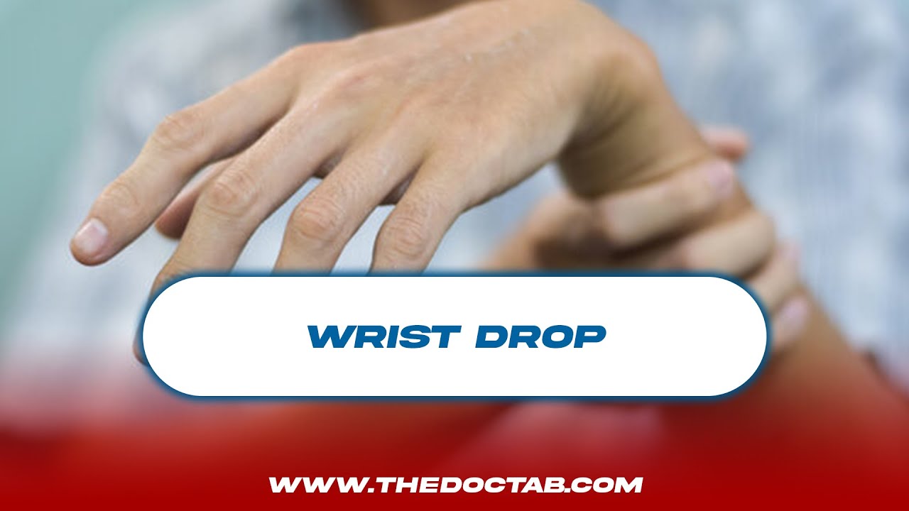 Wrist Drop | Dr. Ezekiel Oburu - YouTube