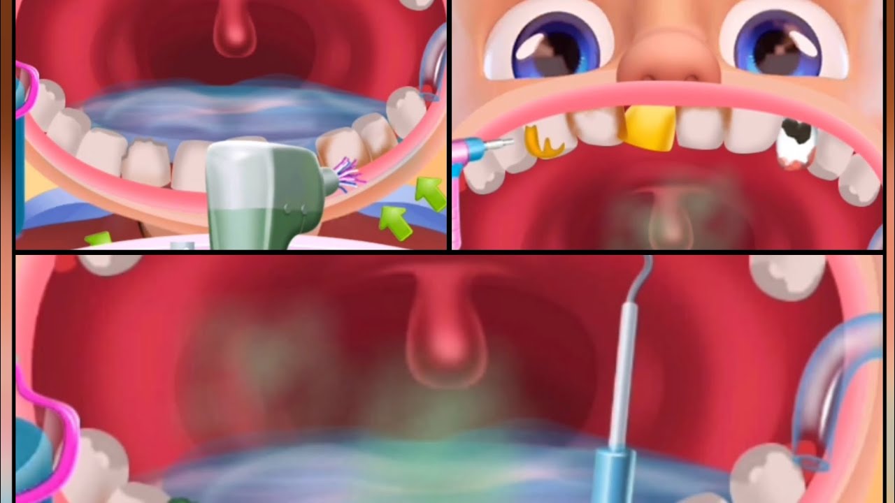 ASMR | "Teeth Cleaning and Dirt Extraction" | "tartar and plaque" #asmr ...