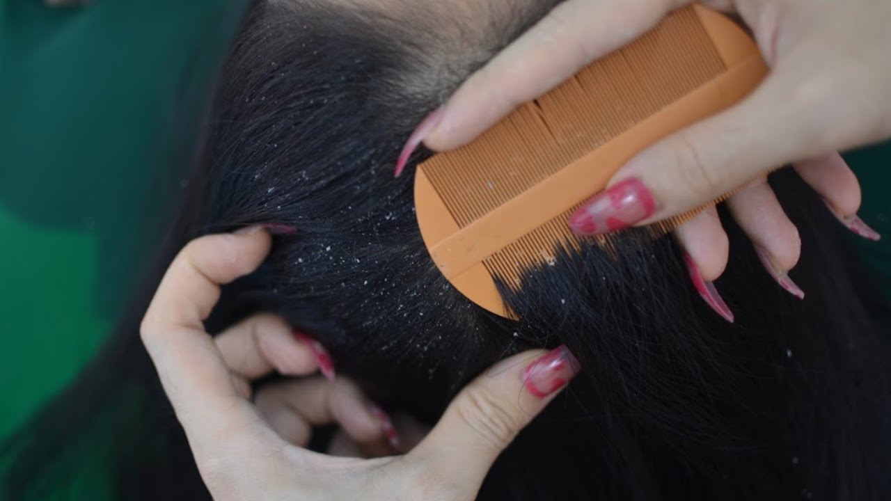 ASMR Scalp Scratching, Melting Scalp Massage, Hair Brushing, Hair ...