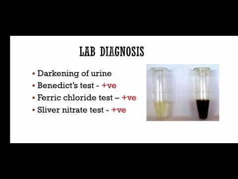 Alkaptonuria - Biochemical defects, clinical features, lab diagnosis ...