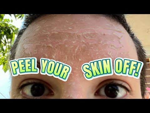 PEEL YOUR SKIN OFF - YouTube