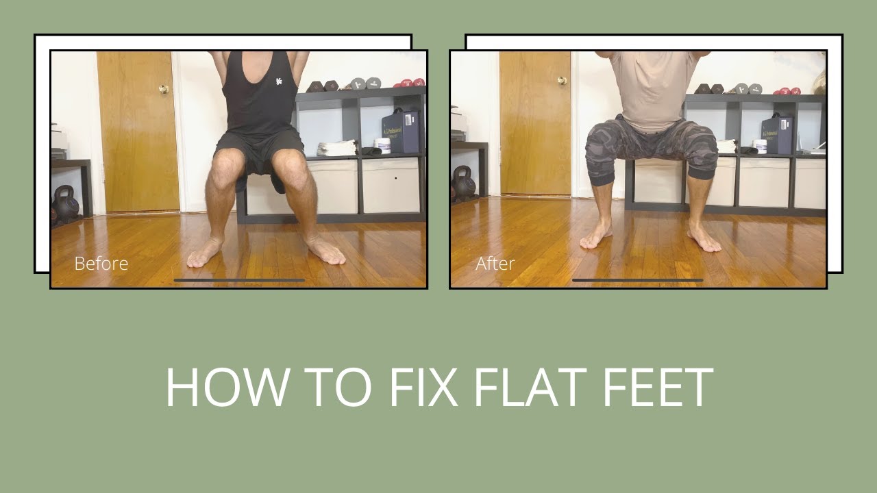 How To Fix Flat Feet - YouTube