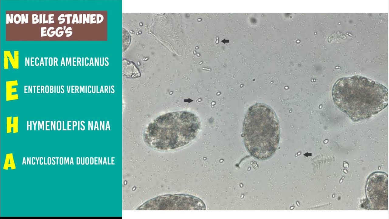 Non-bile stained egg's #parasitology - YouTube