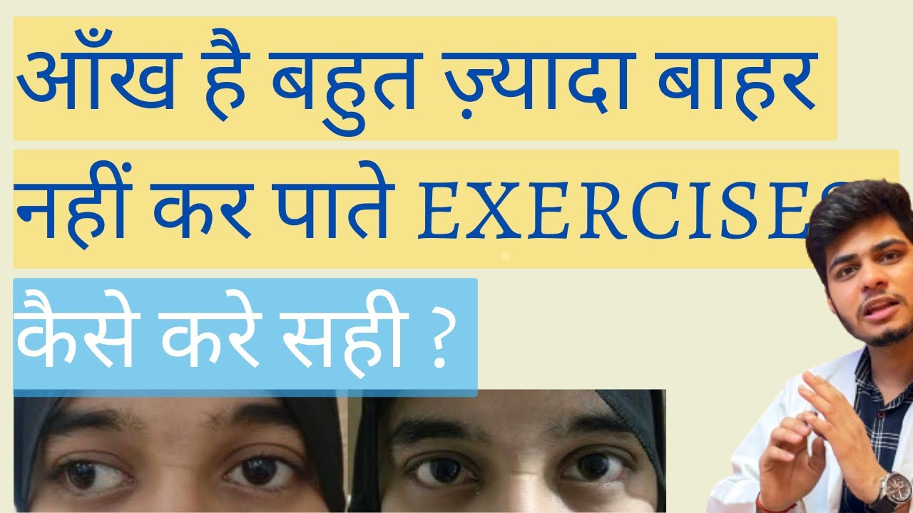 क्या करे वो लोग जो नहीं कर पाते Squint Exercises | How to treat squint ...