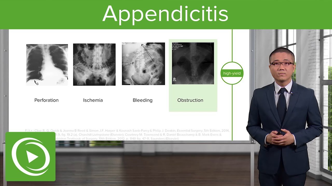 Acute Abdomen Appendicitis And Peritonitis General Surgery Lecturio