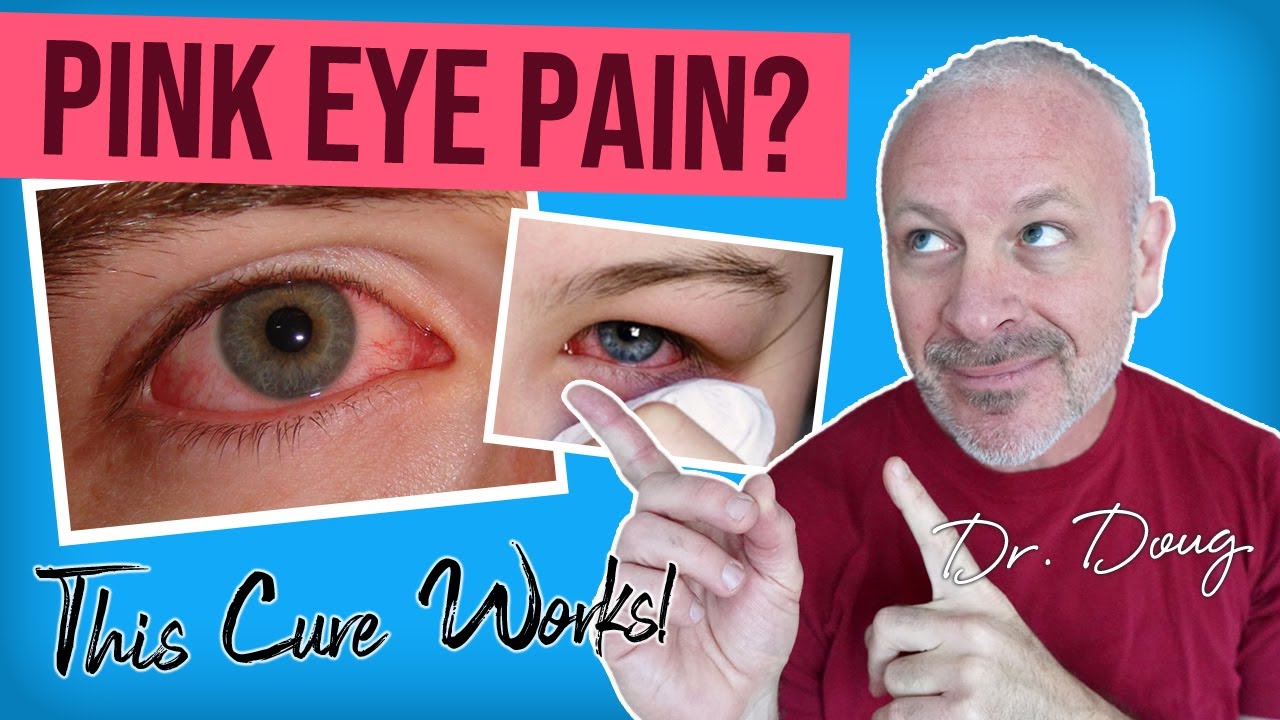 👁 PINK EYE 👁 CURE! | Dr. Doug - YouTube