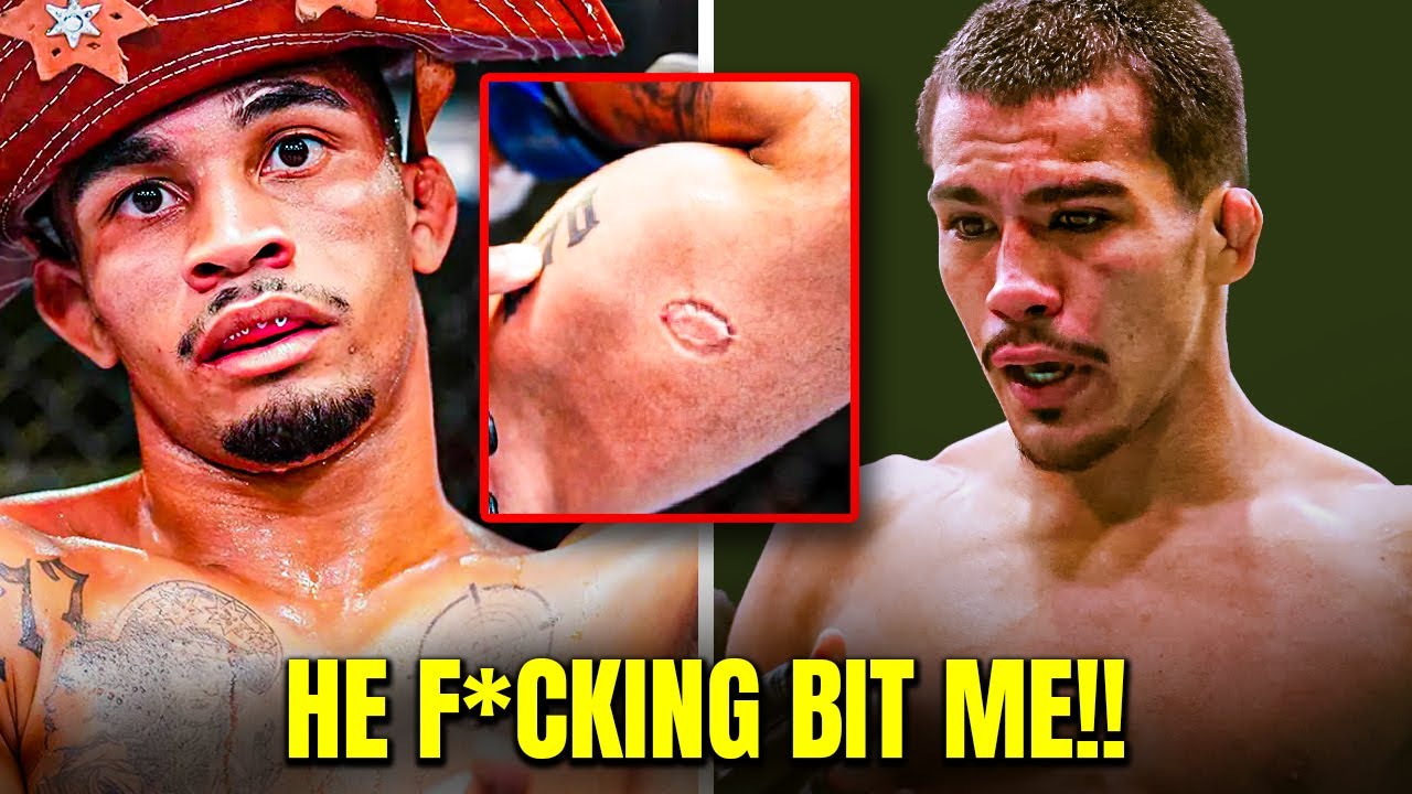 UFC Fighter Igor Severino BANNED And FINED For BITING Opponent!! - YouTube