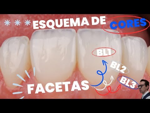 🔴REVELEI ESQUEMA DE CORES FACETAS: BL1, BL2 E BL3🤩 COM APENAS DUAS ...