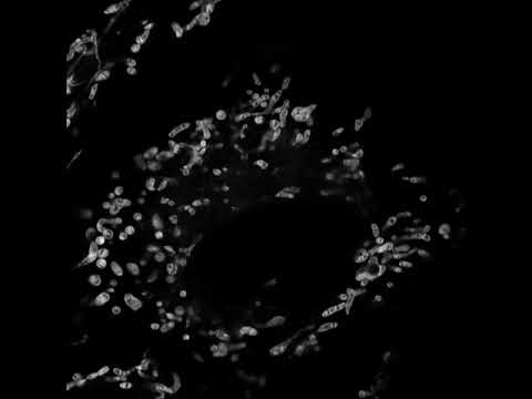 Real time live cell imaging of mitochondria - YouTube