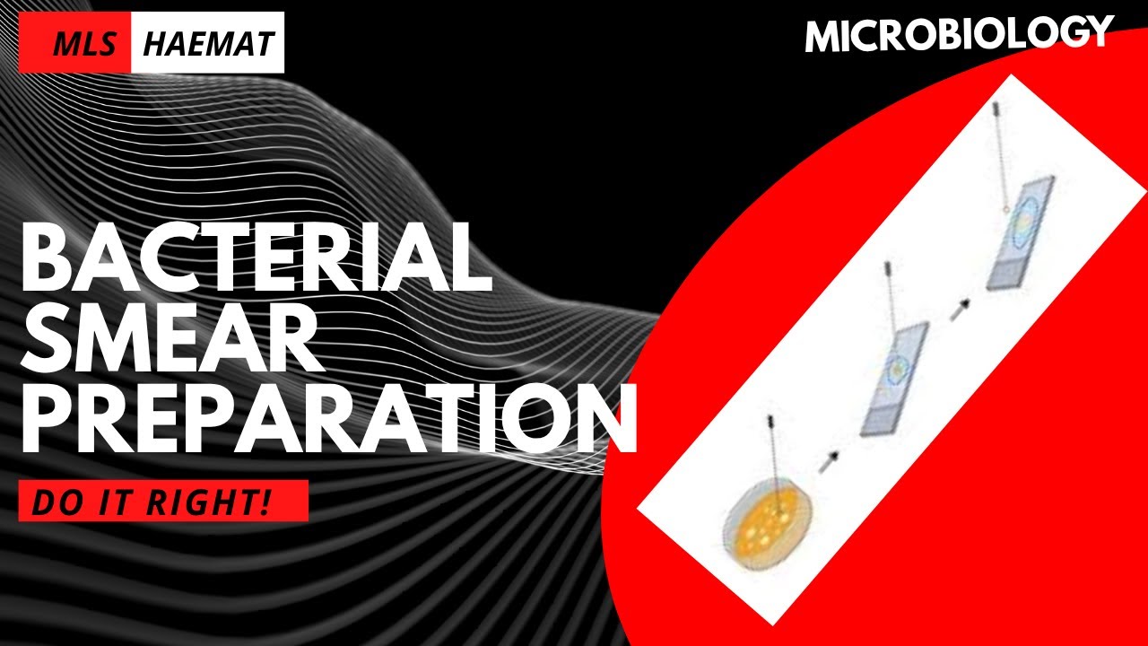 BACTERIAL SMEAR PREPARATION - YouTube