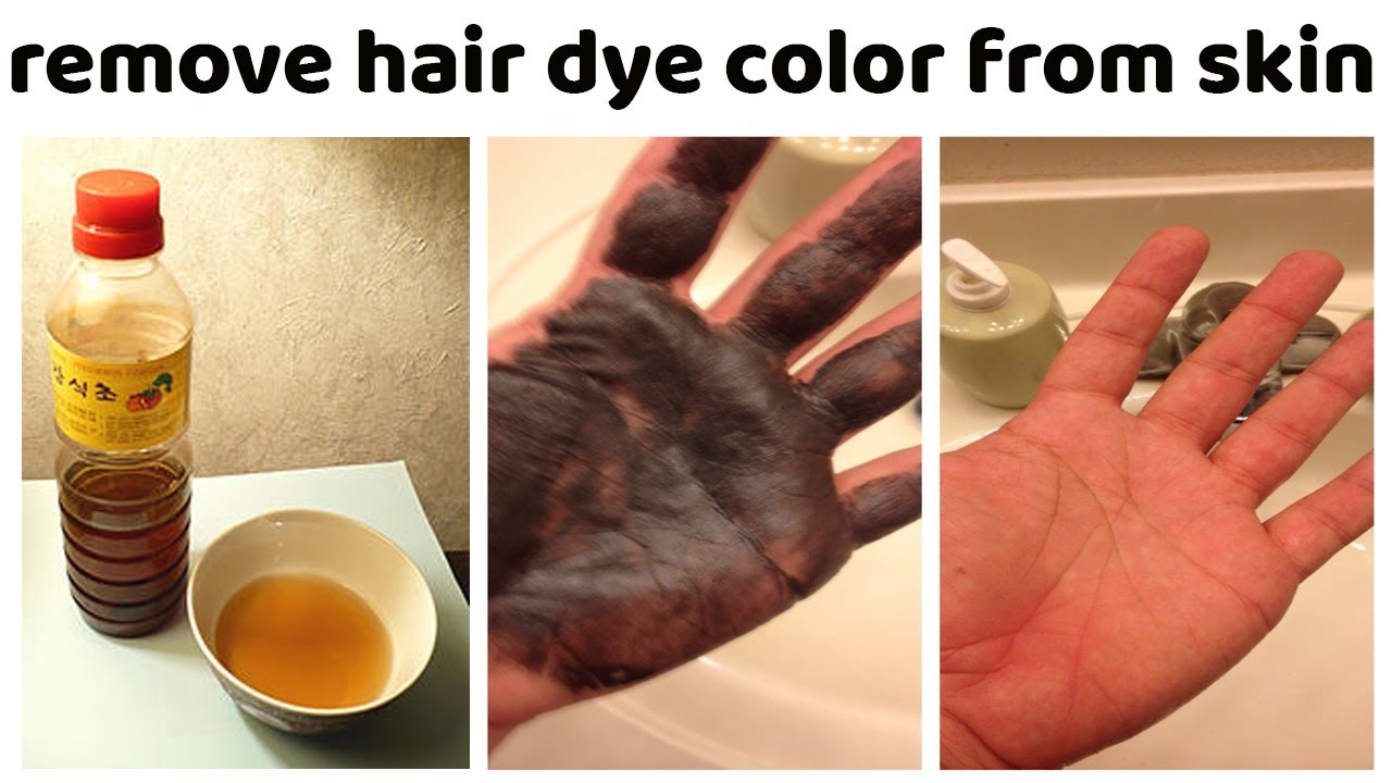 How To Remove Hair Dye Color From Skin Easily Youtube