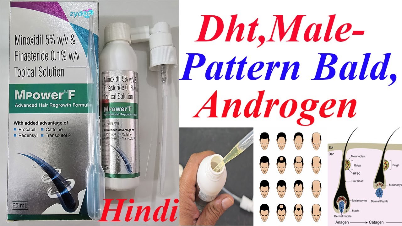 Mpower F Solution Uses | Minoxidil (5% w/v) + Finasteride (0.1% w/v) |DHT |Androgen | Male ...