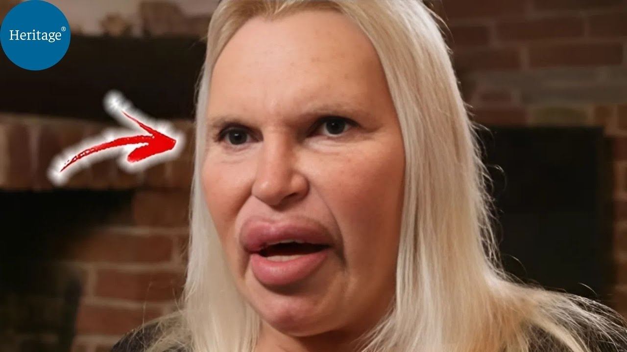 Top 20 Famous Actors With Shocking PLASTIC SURGERY - YouTube