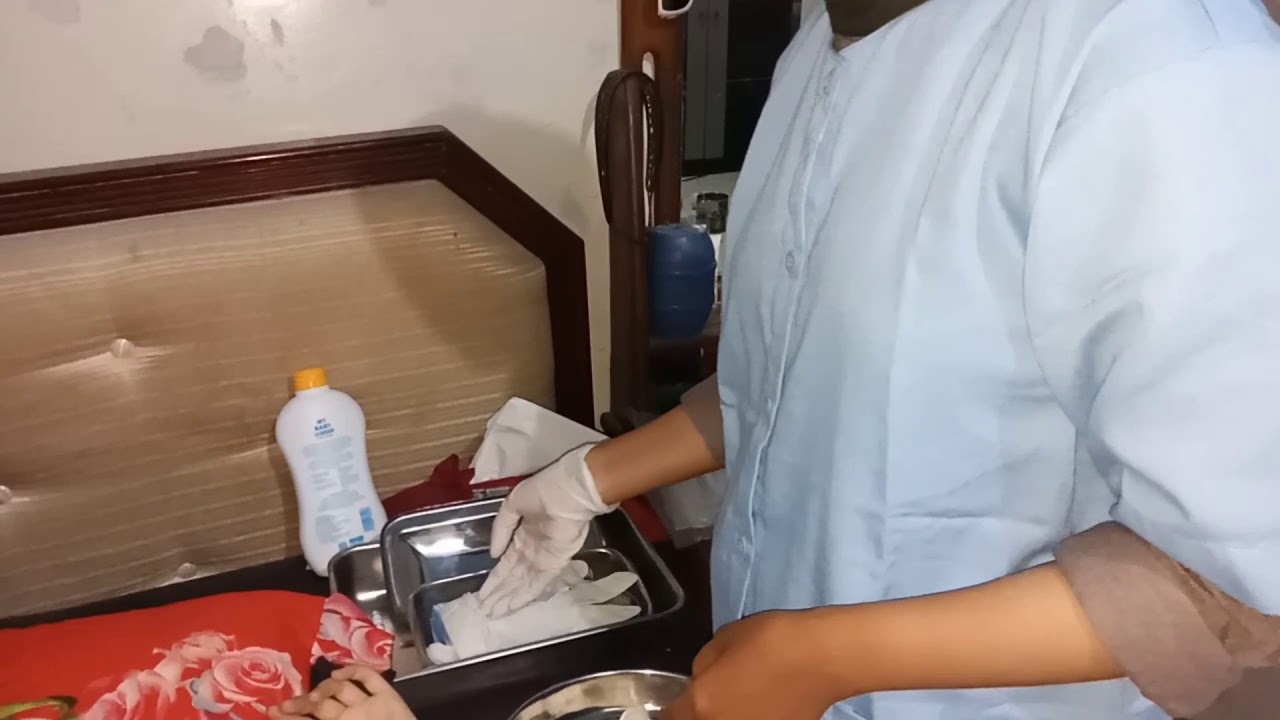 PEMASANGAN KB IMPLANT - YouTube