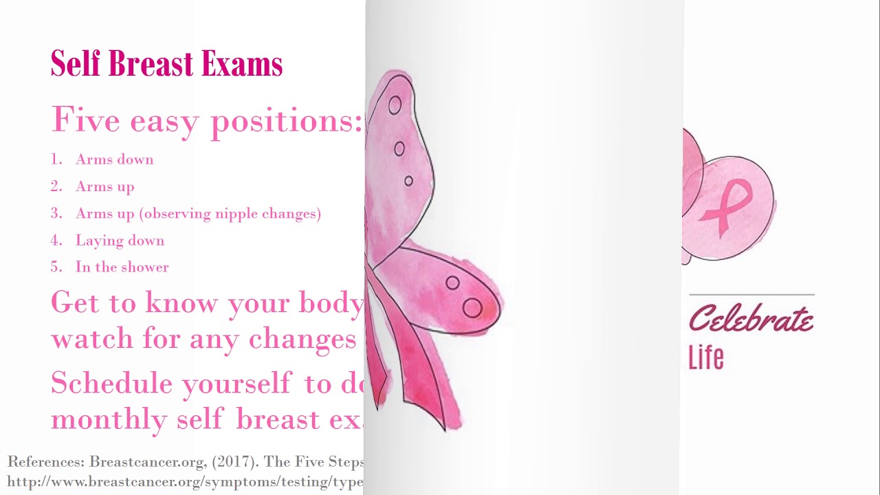 Group30-BreastCancer-Epi101_Fall 2017 - YouTube