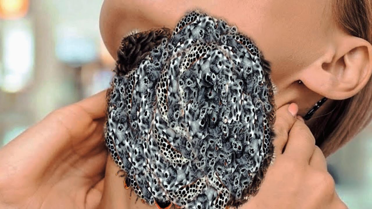 ASMR Treatment Collection | ASMR removal Spiders & trypophobia infected ...