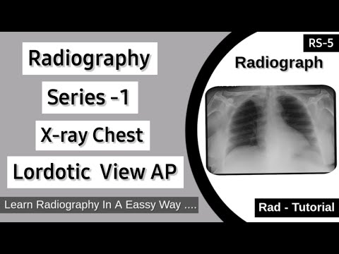 Radiography Series-1, x-ray Chest Apical (Lordotic) AP View / RT-5.# ...