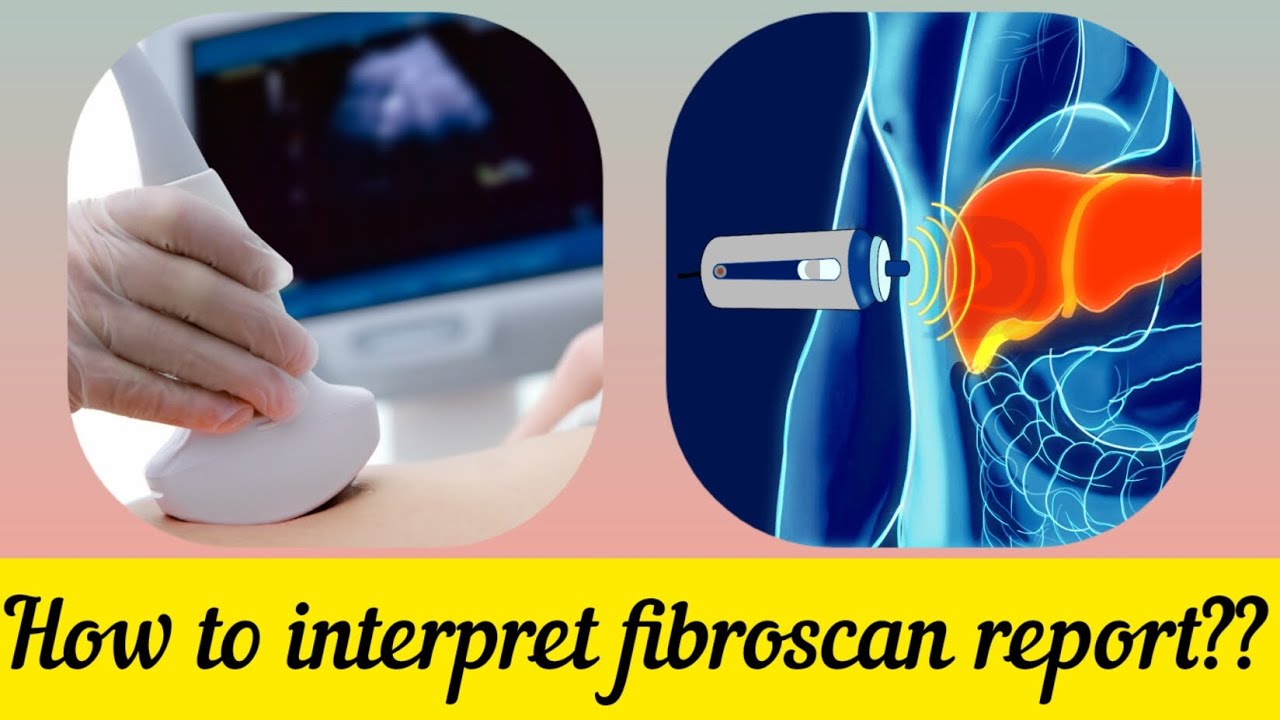 What Is FibroScan Fibroscan DrAshishSachan