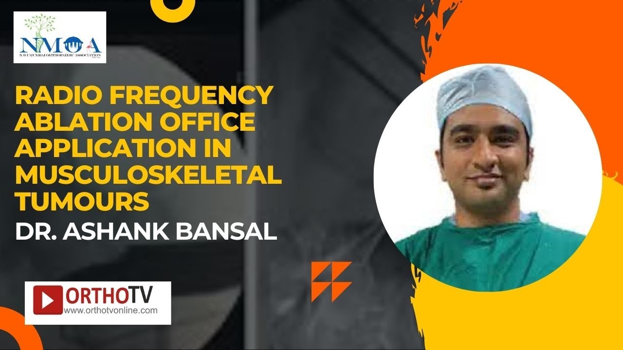NMOACON 2022:Radio frequency ablation office application in musculoskeletal tumours-DR ASHANK ...