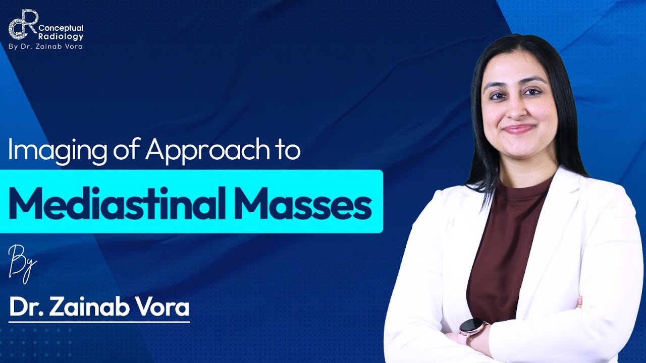Imaging of Approach to Mediastinal Masses | Dr. Zainab Vora ...