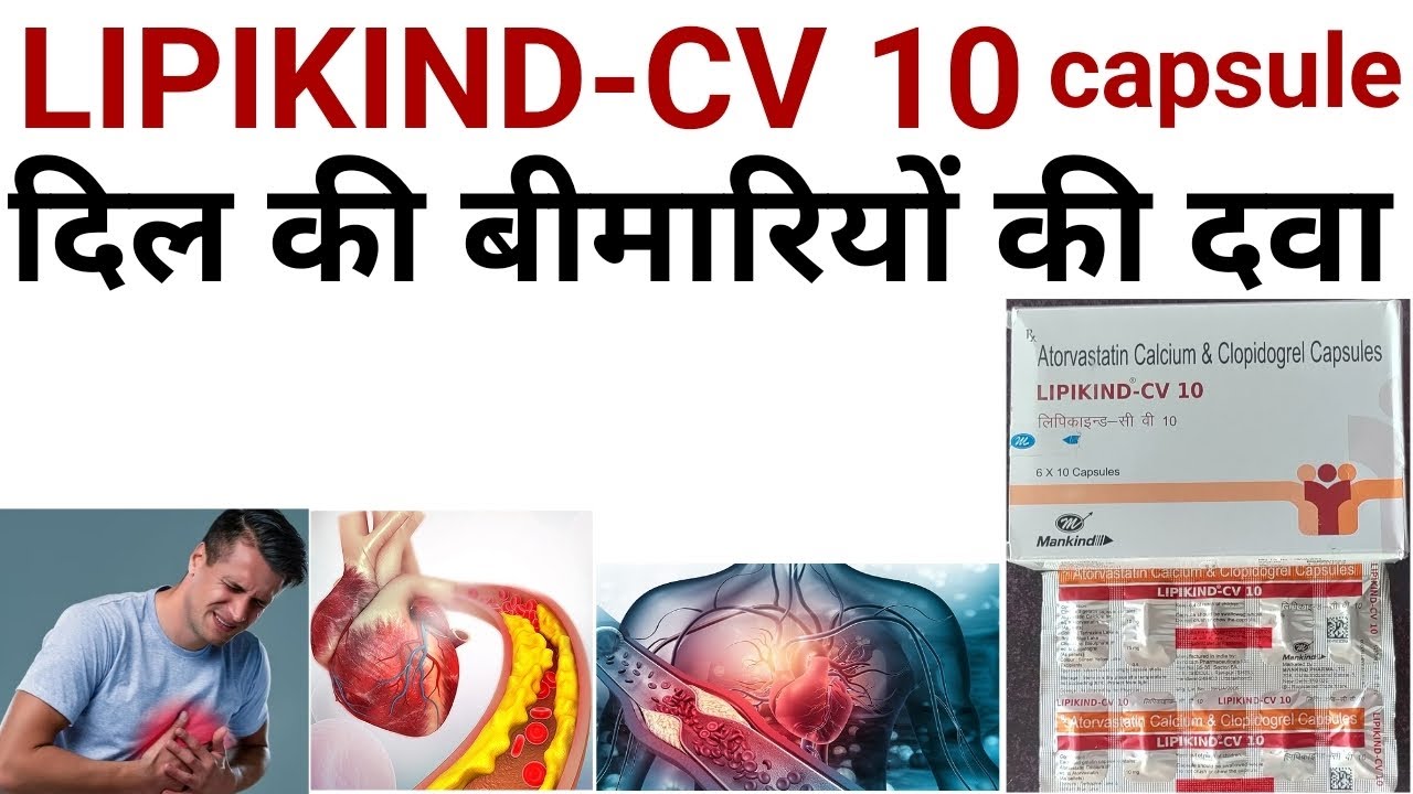 Lipikind cv 10 capsule/atorvastatin calcium & clopidogrel uses in hindi ...