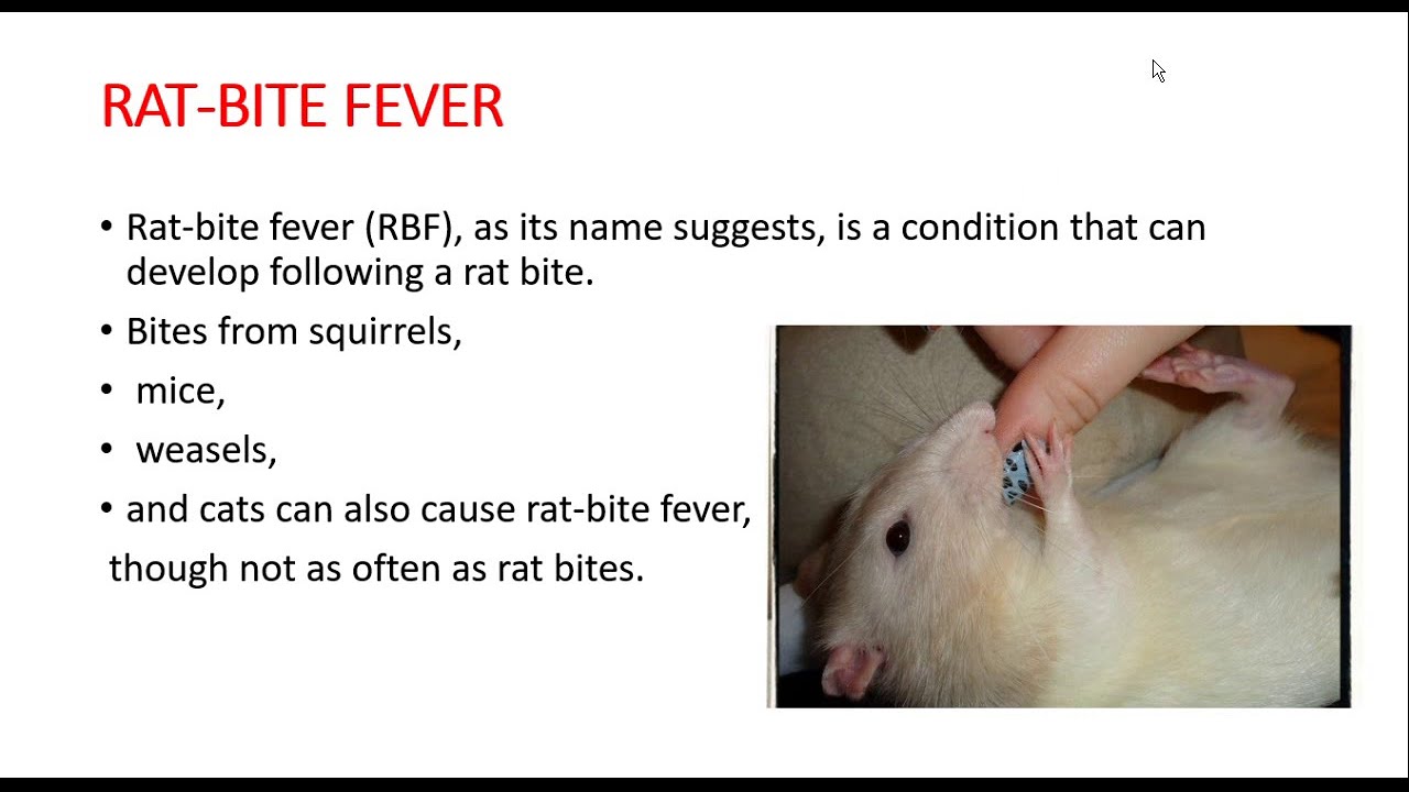 Rat-Bite Fever| A Zoonotic Disease - YouTube
