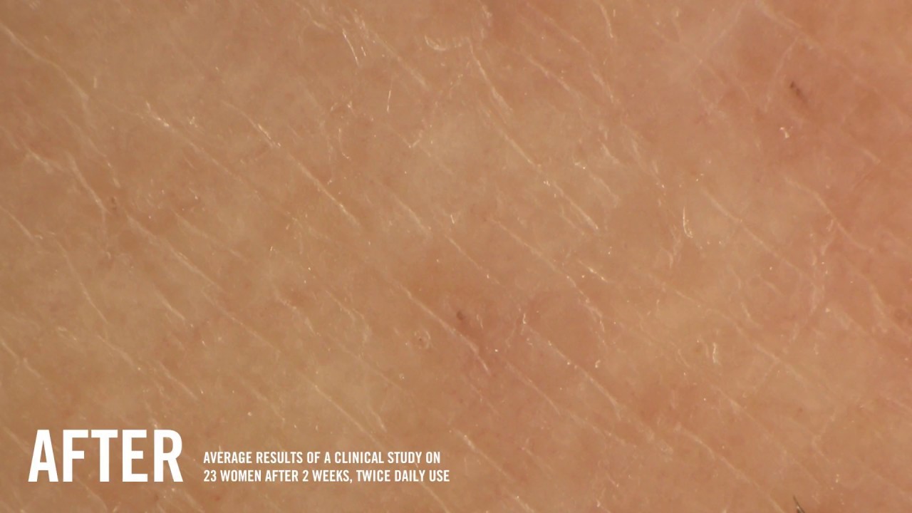 Before and After Ultra Repair Cream - YouTube