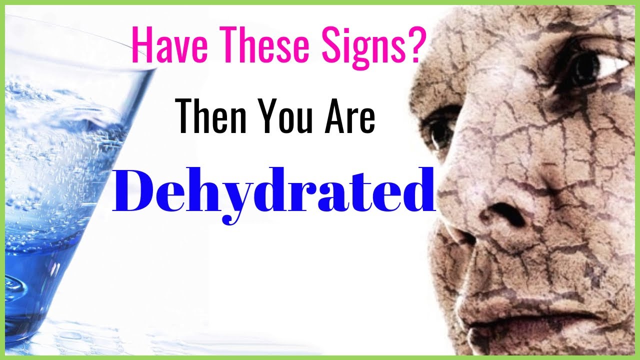 Dehydration Symptoms 7 Signs Tell You Need To Drink More Water Youtube