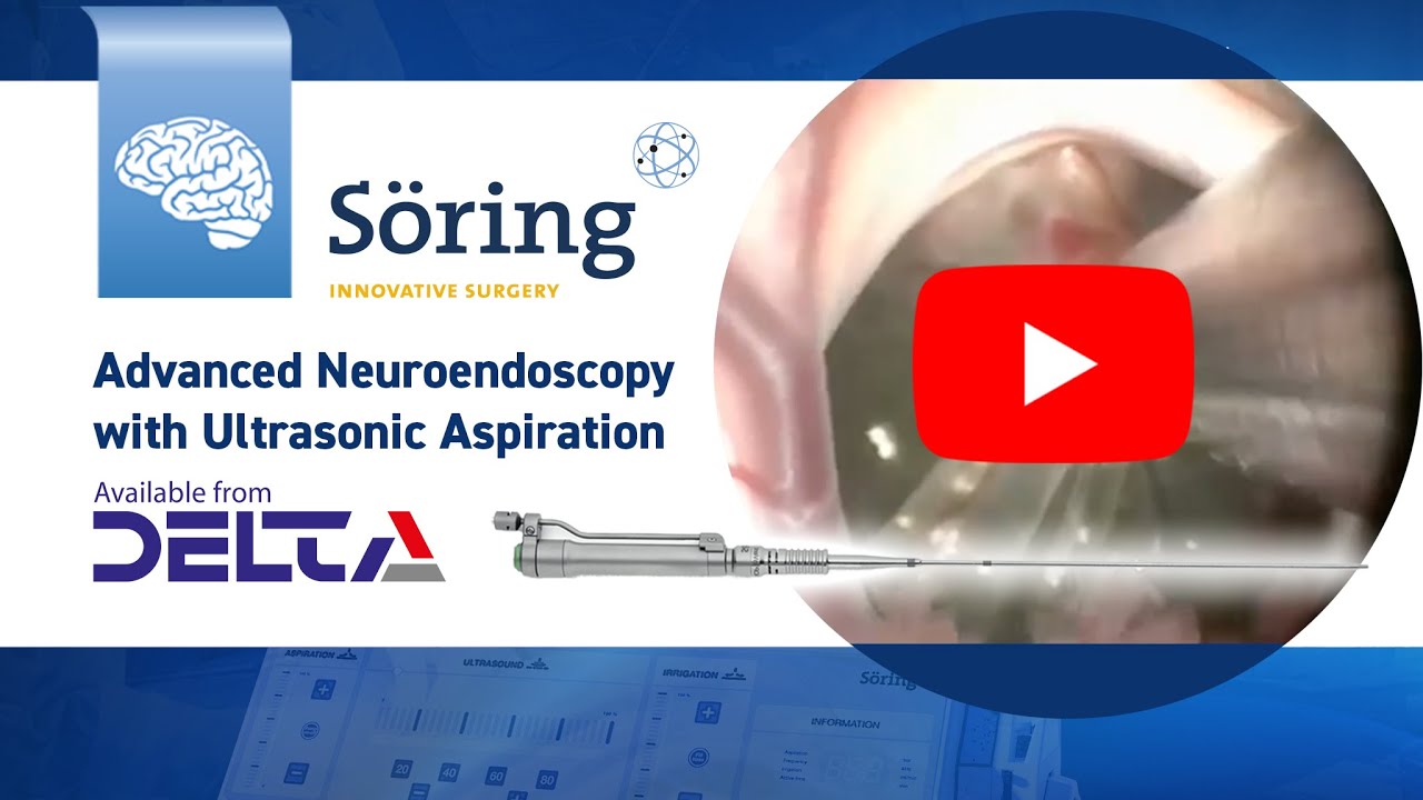 Soring Advanced Neuroendoscopy with Ultrasonic Aspiration video - YouTube