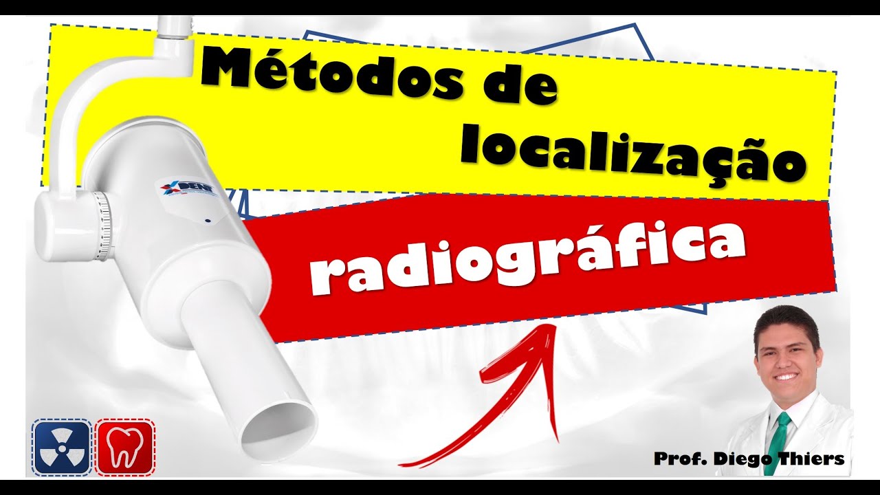 Tecnica De Miller Winter - RETOEDU