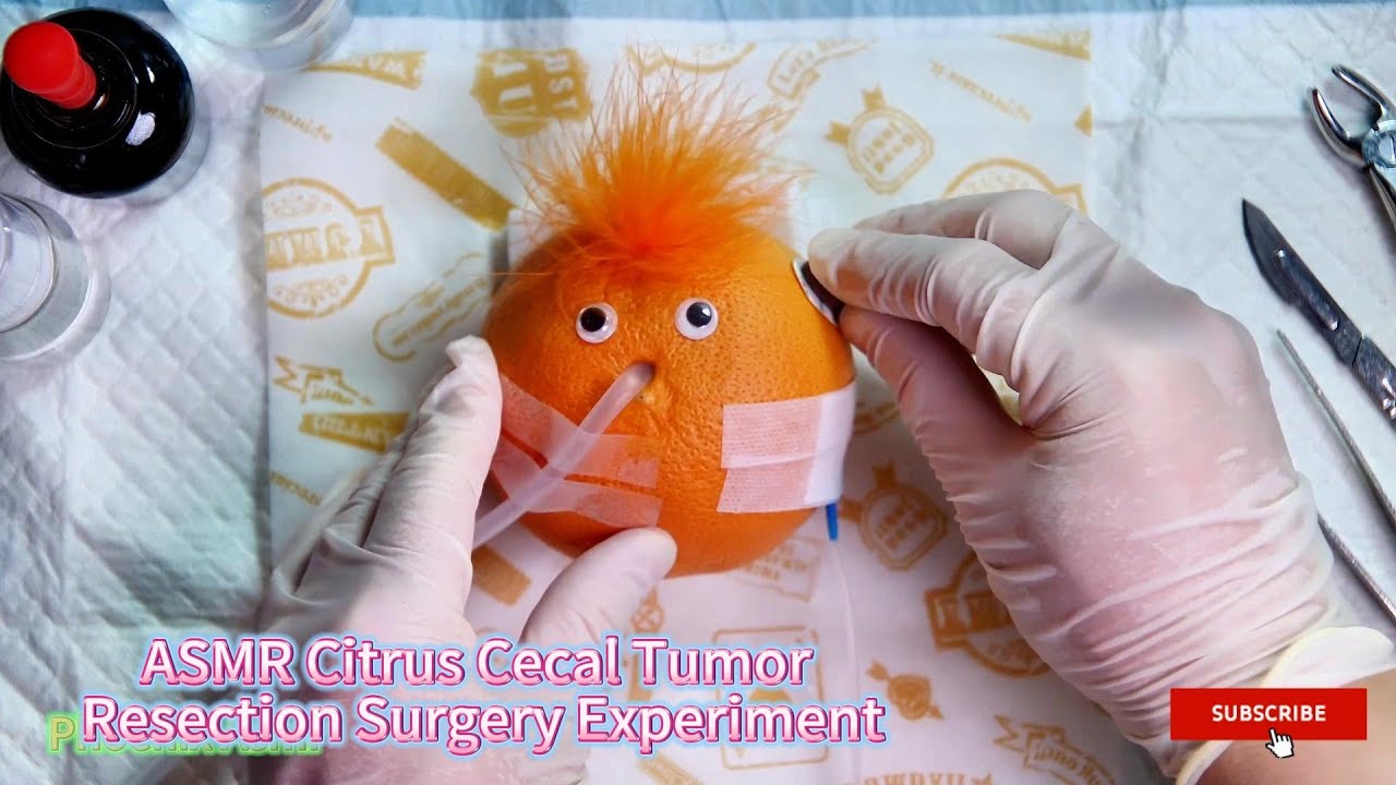 ASMR Citrus Cecal Tumor Resection Surgery Experiment | Real Relaxation ...